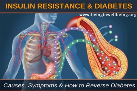 Do You Know What Is Insulin Resistance - Living In Well Being
