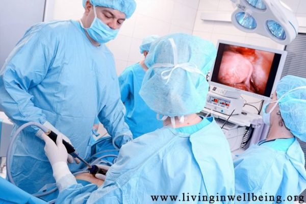 Advantages of Laparoscopy Over Open Surgery - Living In Well Being